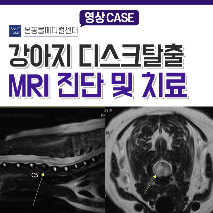 강아지가 갑자기 잘 못걸어요 강아지 뒷다리에 힘이 없어요 강아지 급성 비압박성 디스크탈출증annpe Mri 진단 및 치료