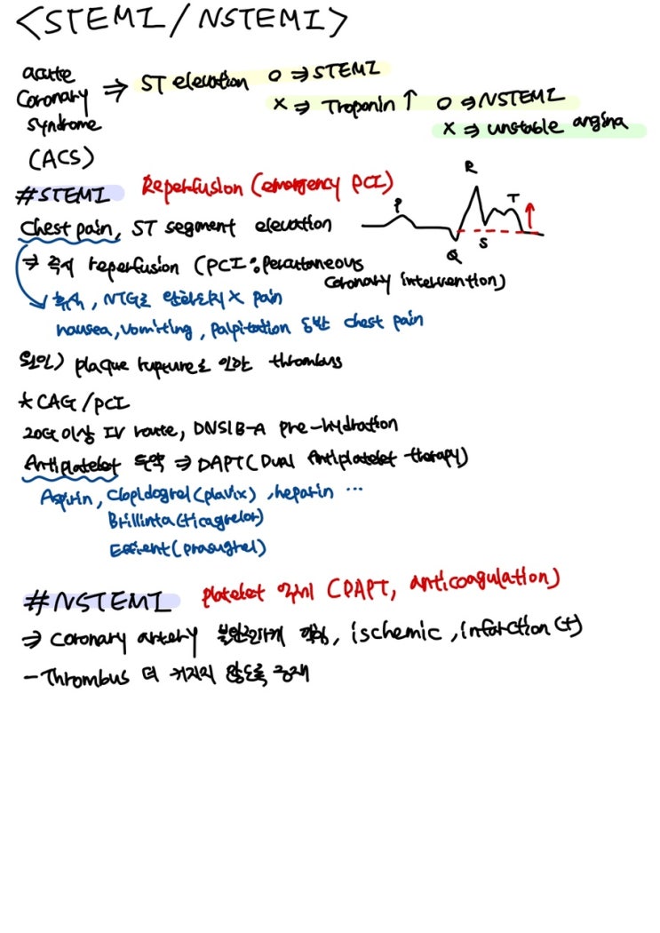 STEMI, NSTEMI, 12 lead EKG 해석(LAD, LCx, RCA) : 네이버 블로그