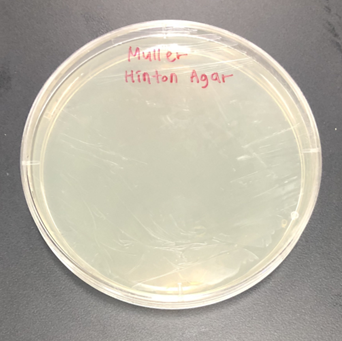 항균시험 소개 – Paper disk method 법 : 네이버 블로그