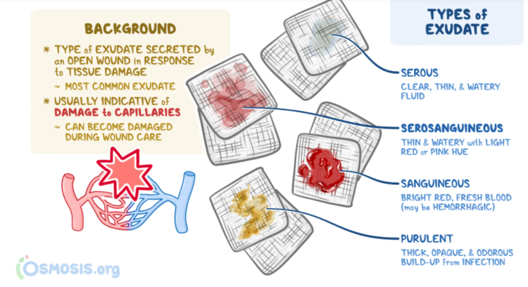 배액관 및 배액양상(bloody, sanguineous, seros) : 네이버 블로그