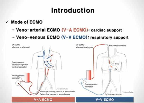 ECMO 기본이론_ ECMO mode 소개, 삽입 전후 간호, 모니터링, 합병증, weaning : 네이버 블로그