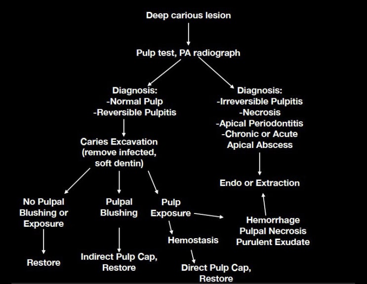 신경치료 피하는 법 (direct pulp capping) : 네이버 블로그