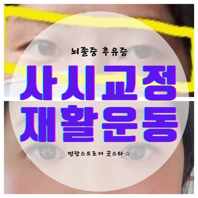 사시교정 오투스 안구운동기로 뇌졸중 후유증 극복하고 있어요 네이버 블로그