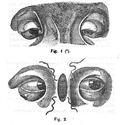 epicanthischen Lehre(몽고주름학설), epicanthus hypothesis(몽고주름가설) : 네이버 블로그