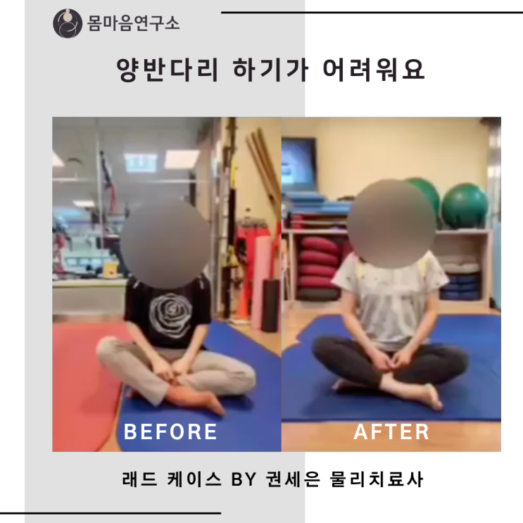 양반다리 및 무릎꿇기가 안 되요 Feat 후방십자인대 파열 네이버 블로그