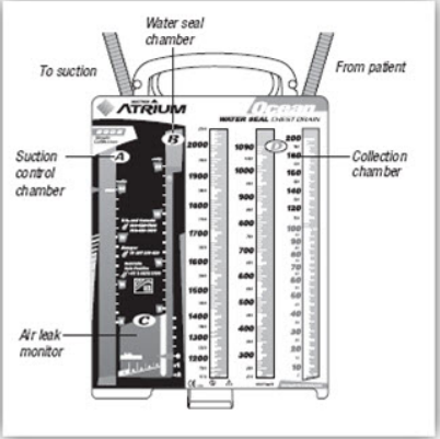 Chest Tube Bubbling : 네이버 블로그