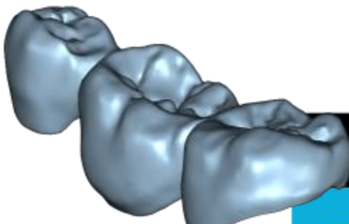 DCM 확장자 STL로 쉽게 변환하는 방법 : 네이버 블로그