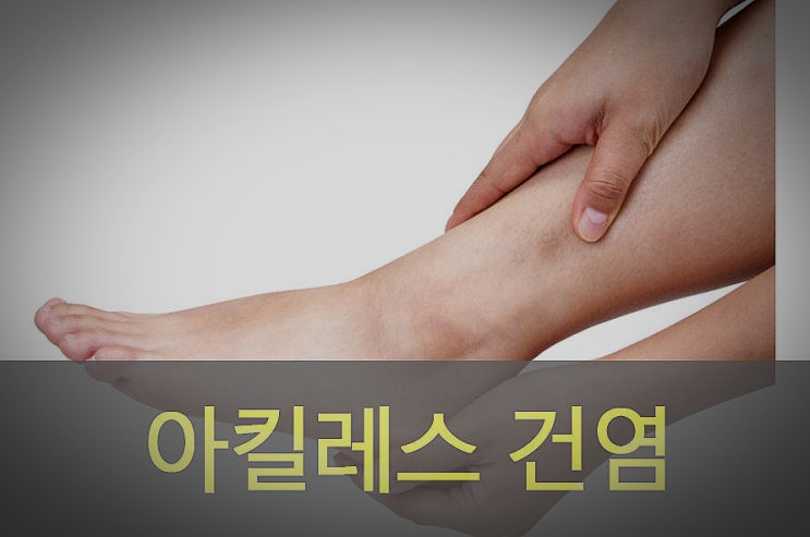 아킬레스 건염 원인과 증상 예방 스트레칭 네이버 블로그