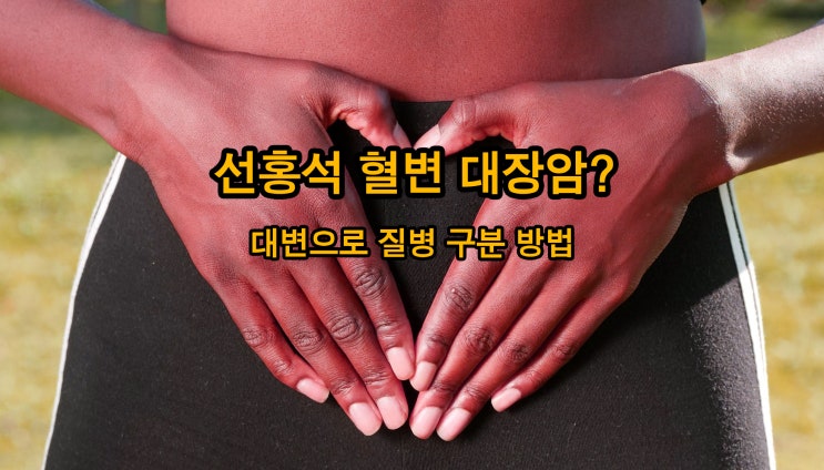 선홍색 혈변 원인 치질 장염 대장암 구분 방법은 네이버 블로그