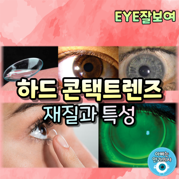 Eye잘보여 하드콘택트렌즈의 재질 그리고 특성 Rgp를 중심으로 네이버 블로그