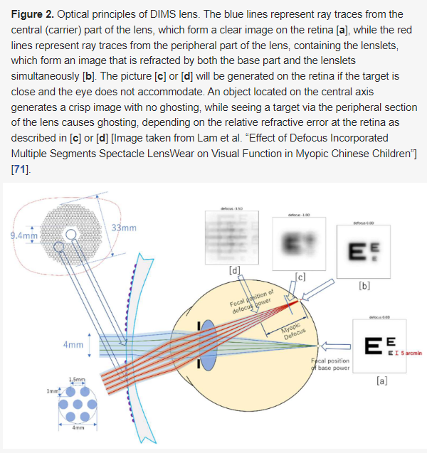 마이오스마트 (MiyoSmart), 스텔리스트(Stellist), 마이오 비전 프로 (Myovision Pro) : 네이버 블로그