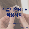 열린보청기 검단점 포낙보청기 귀걸이형 Bte 착용사례 고심도난청 80세 아버님 청각장애 복지카드 포낙 스카이m