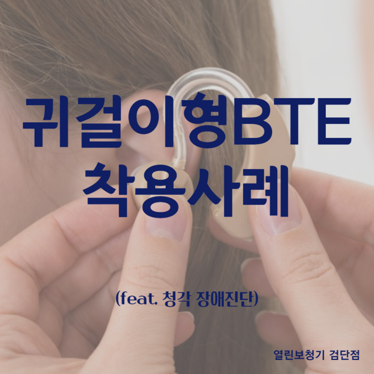 열린보청기 검단점 포낙보청기 귀걸이형 Bte 착용사례 고심도난청 80세 아버님 청각장애 복지카드 포낙 스카이m