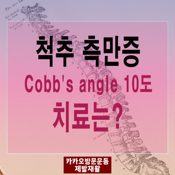 척추 측만증 - Cobb's angle 10도 미만, 치료는? : 네이버 블로그