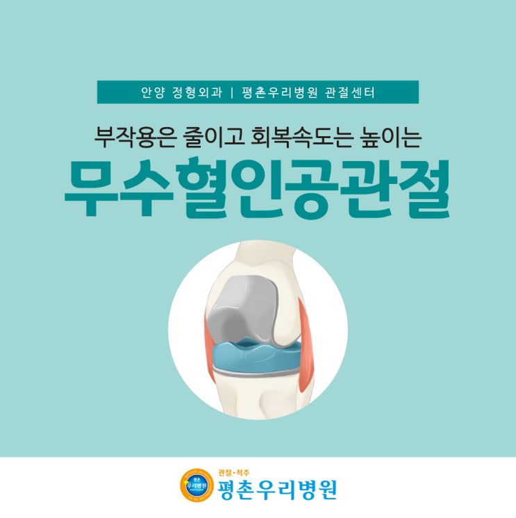 생활 속 의료정보 안양 정형외과 부작용은 줄이고 회복 속도는 높이는 무수혈인공관절 네이버 블로그