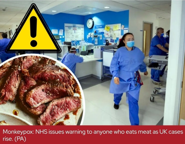 원숭이 두창(Monkeypox)이 영국 내에서 감염사례가 증가함에 따라 영국 보건부(NHS)는 육식을 하는 모든 사람에게 경고를 ...