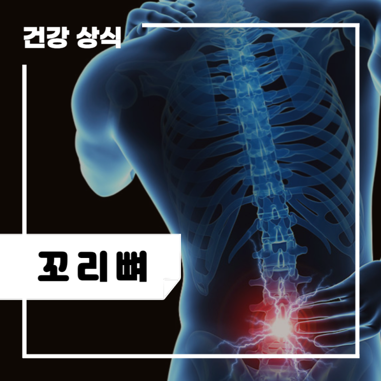 꼬리뼈가 아픈 이유 5가지 및 대처 방법 꼬리뼈 통증골절 금 타박상 네이버 블로그