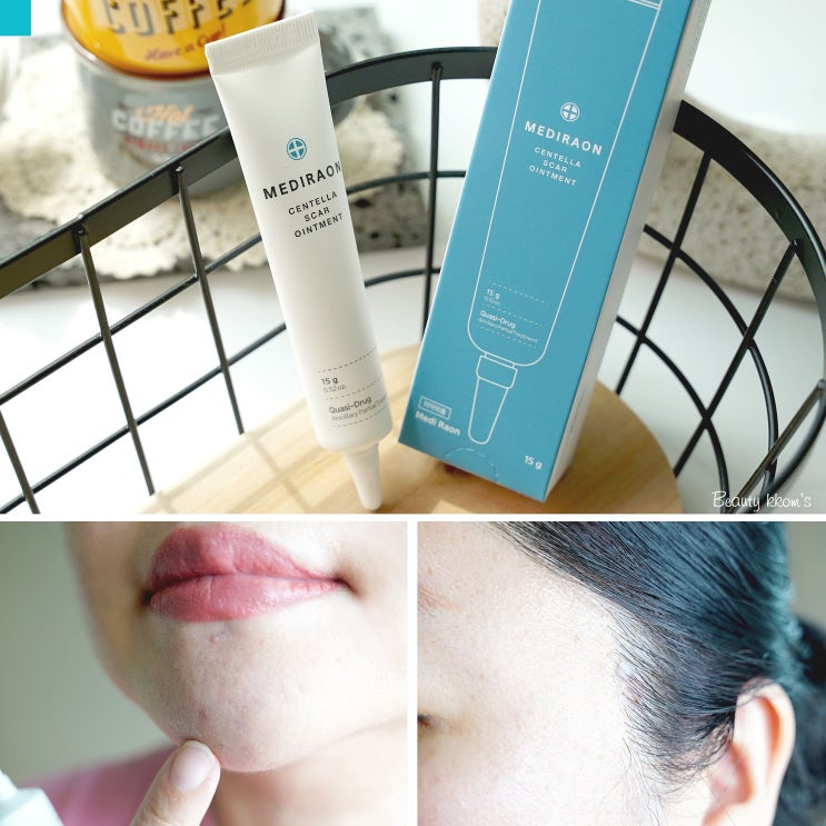 화농성 여드름 턱 두피 모낭염 연고 관리 후기 네이버 블로그