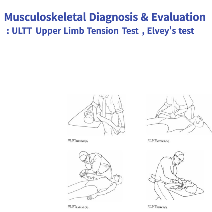 ULTT test Upper Limb Tension Test , Elvey's test : 엘베이 검사 - 상지 신경 긴장 유발 ...