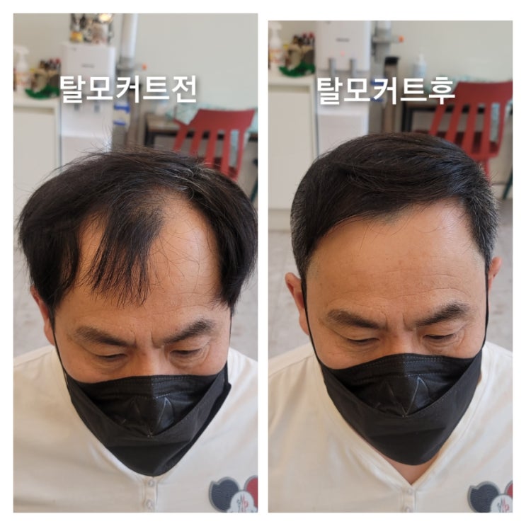 대구탈모남자커트미용실달서구월성동 남성탈모20분만에 일반인되다 네이버 블로그