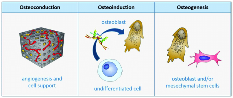 What is the difference between osteoinduction and osteoconduction ...