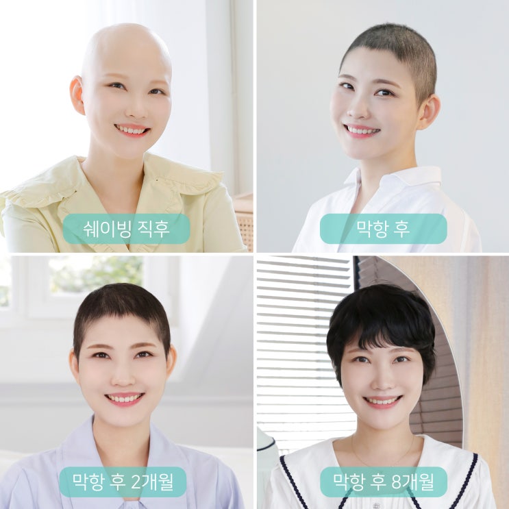 유방암 항암치료 두피관리 막항 후 머리 길이 힐링햇 네이버 블로그