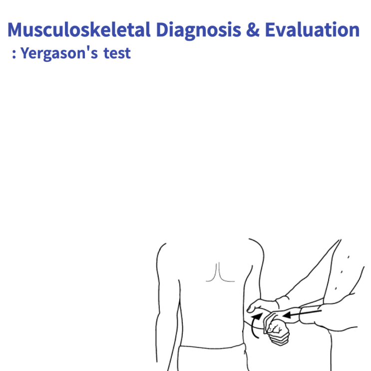 Yergason's test : 요르가손 검사 - 위팔두갈래근 건염 , SLAP : 네이버 블로그