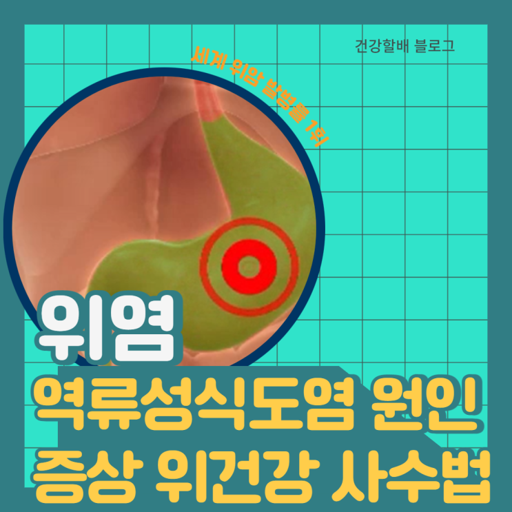 위염 역류성 식도염 원인 증상 위 건강 사수 법 네이버 블로그
