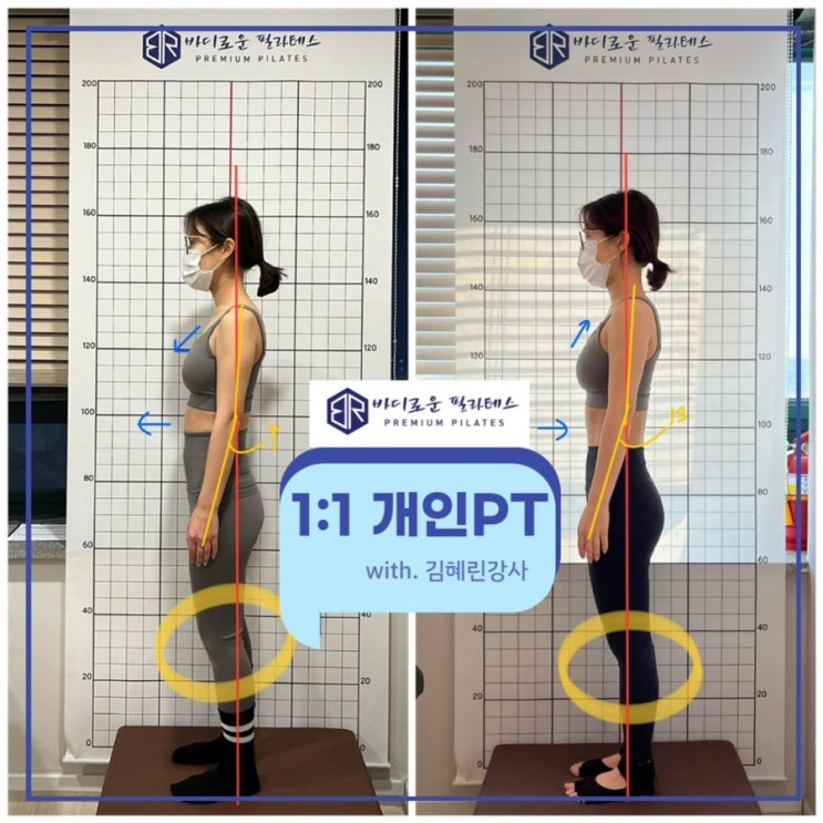 체형교정 전문 센터 바디로운 필라테스 허리디스크 통증 완화 후기덕천 필라테스 덕천pt 덕천기구필라테스 네이버 블로그