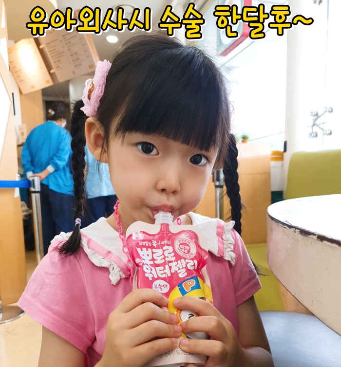 외사시수술 당일~ 한달까지 수술후 첫진료 후기 네이버 블로그