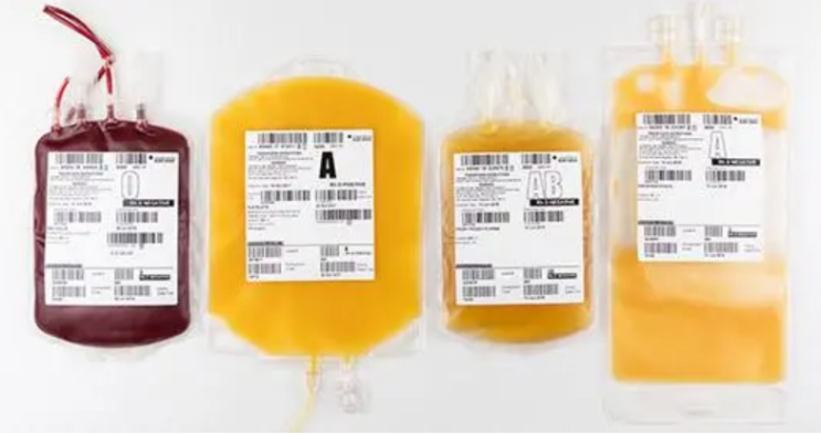 Transfusion(수혈) pRBC, FFP, Platelet, cryoprecipitate : 네이버 블로그