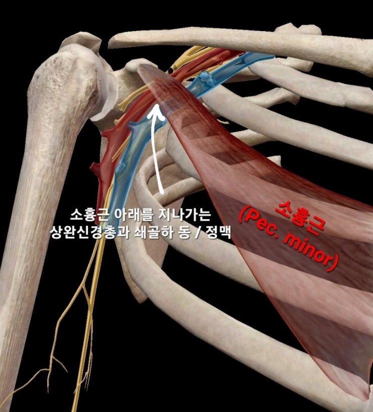 소흉근 증후군(Pectoralis minor syndrome) : 과외전 검사(Wright test) : 네이버 블로그