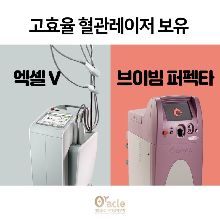 여드름 붉은 자국 흉터 가리지 말고 혈관레이저 하세요 브이빔 엑셀v 레이저 치료 대전 피부과 둔산동 오라클피부과 네이버 블로그