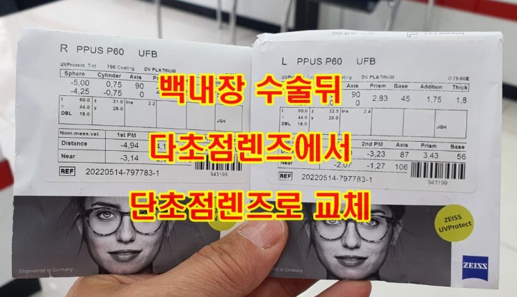 다초점렌즈로 백내장 수술을 했다가 불편해서 다시 단초점렌즈로 교체 더 큰 문제는 양안시 이상증상과 황반변성골프칠때