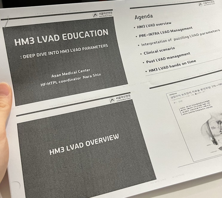 3세대 LVAD(HM3) : 네이버 블로그