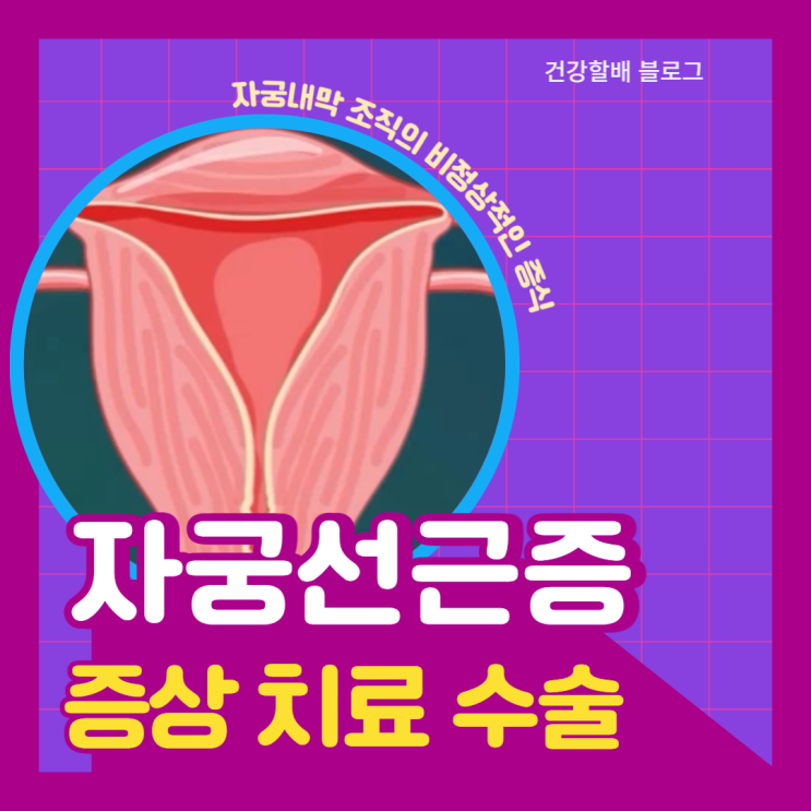자궁 선근증 증상 치료 수술 알아보기 네이버 블로그