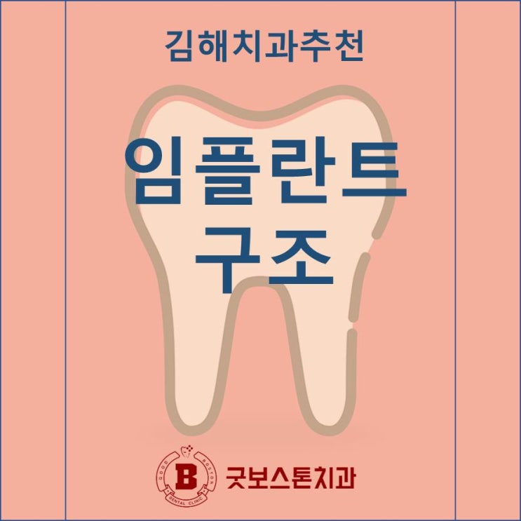 김해 삼방동어방동 굿보스톤치과와 함께 알아보는 임플란트 구조 네이버 블로그
