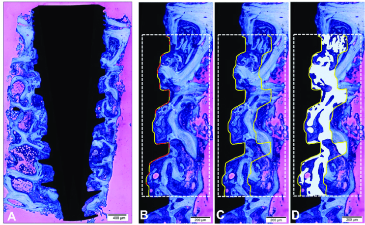 UV 임플란트, 자외선의 패러독스 : 네이버 블로그