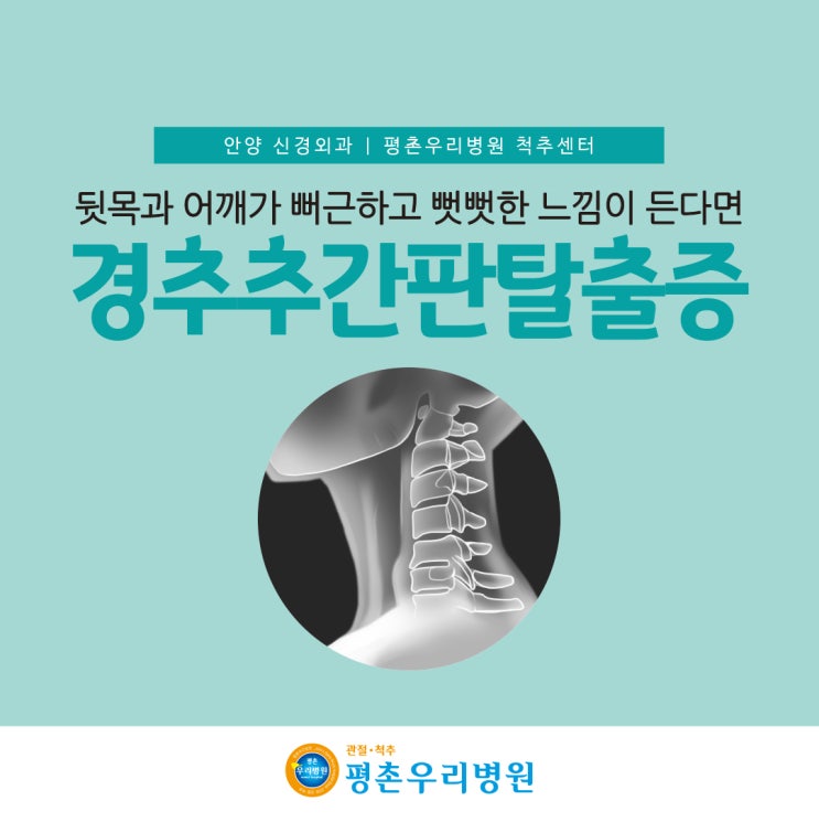 생활 속 의료정보 안양 신경외과 뒷목과 어깨가 뻐근하고 뻣뻣한 느낌이 든다면 경추추간판탈출증 의심 네이버 블로그
