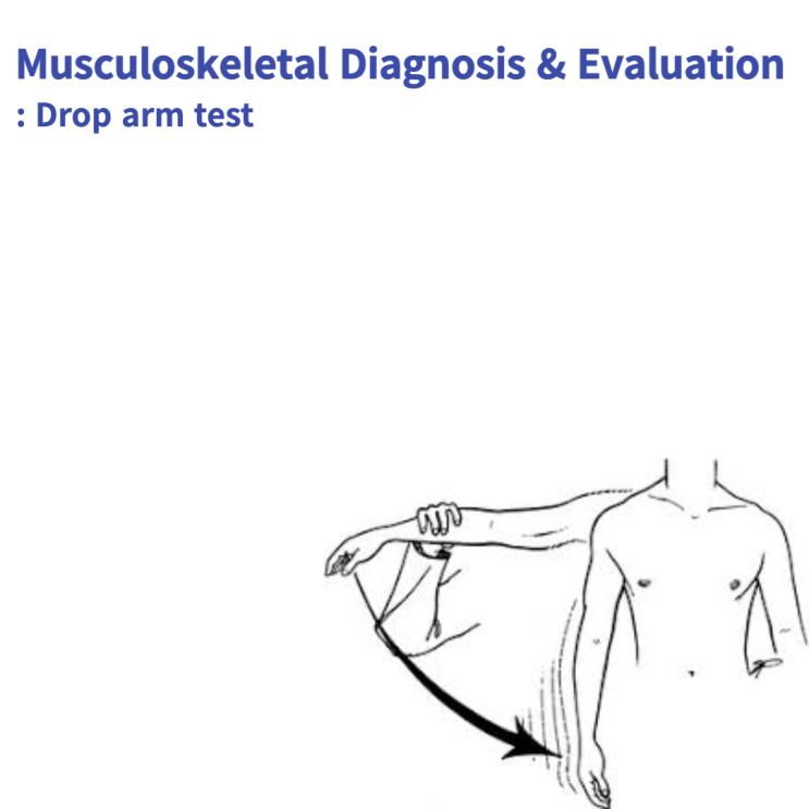 Drop arm test : 드롭암 테스트 - 가시위근 평가 : 네이버 블로그