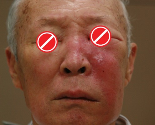 공보의 일상 3 - 볼이 부풀어 오른 환자를 만나다 : 네이버 블로그