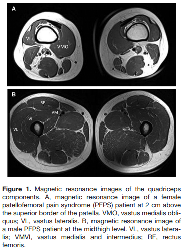 Fact-checking VMO for PFPS (ft. Tom Goom) : 네이버 블로그