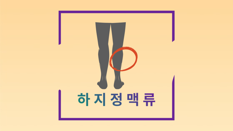 종아리 통증 다리 실핏줄 원인 하지정맥류 증상 하지정맥류 예방 방법 네이버 블로그