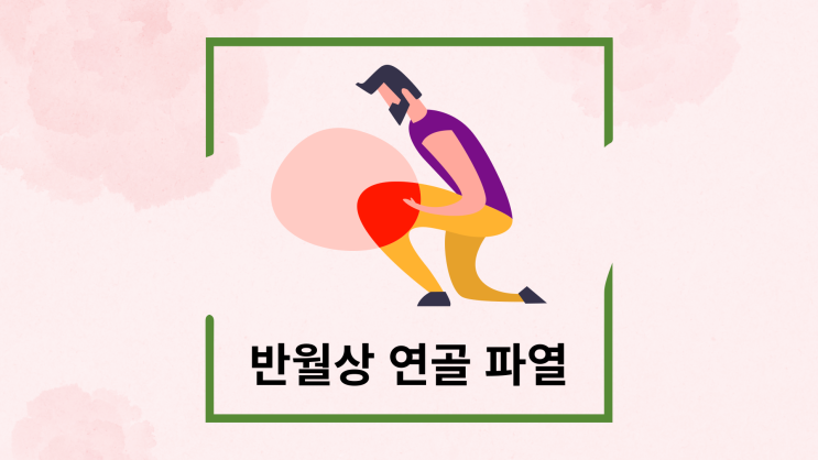 반월판 반달연골 손상 반월상 연골 파열 증상 및 치료 무릎 연골 찢어짐 네이버 블로그