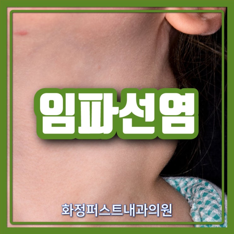 덕양 임파선염 증상 및 치료법 숙지하세요 네이버 블로그