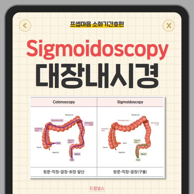 sigmoidoscopy vs colonoscopy 차이점, 주의점 : 네이버 블로그