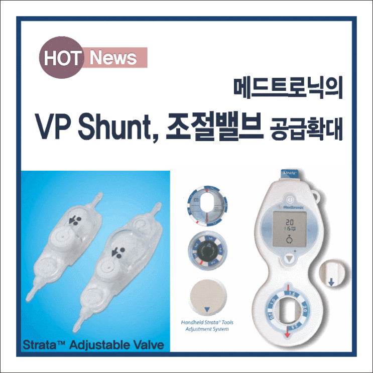 [Hot News]메디레이, VP Shunt 조절밸브 공급확대 : 네이버 블로그