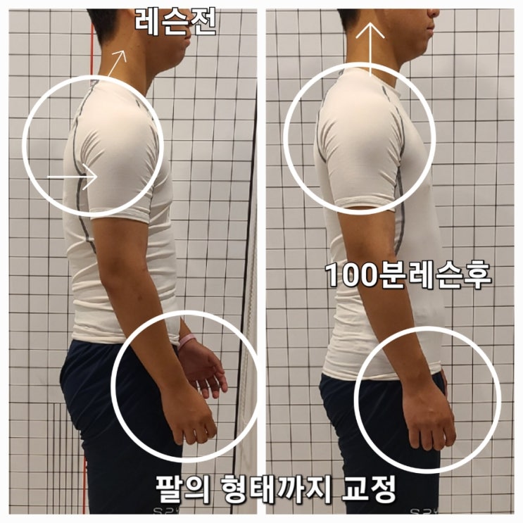 춘천필라테스 체형교정 보행교정 빠르게 100분에 가능원데이교정레슨으로 놀라운 변화를 만들어 드립니다 네이버 블로그