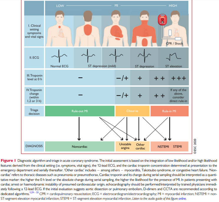 Steminstemi Guideline St분절 상승 급성심근경색 St분절 비상승 급성심근경색 치료 가이드라인 네이버 블로그