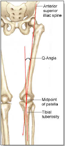 전방십자인대(ACL) 부상 역학 / 남녀 차이, Q-angle : 네이버 블로그